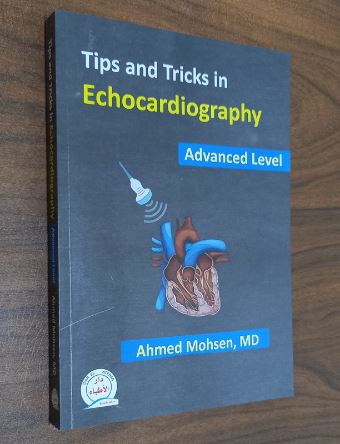 Tips and Tricks in Echocardiography: Advanced Level – ABC Books