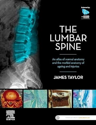 The Lumbar Spine : An Atlas of Normal Anatomy and the Morbid Anatomy o ...